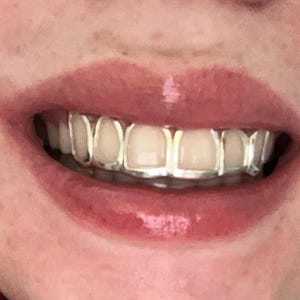 Silver Grillz 925 Sterling Silver Teeth Real Diamond Cut Custom Silver ...
