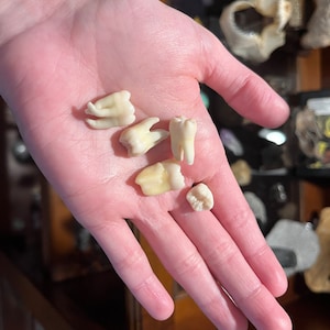 10 Real Human Teeth molars, Premolars, & Anteriors - Etsy