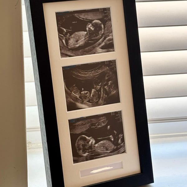 Baby Scan Photo Frame - Multi Aperture Frame for Three Scan Sized ...