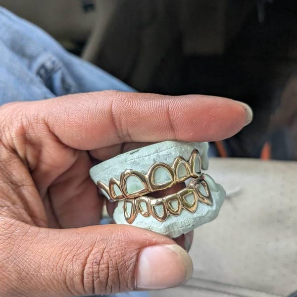 The BEST Mold Kits for Grillz Mold Impression Kit for Custom Grillz ...