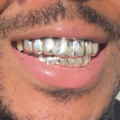 The BEST Mold Kits for Grillz Mold Impression Kit for Custom Grillz ...