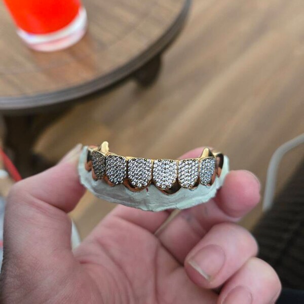 The BEST Mold Kits for Grillz Mold Impression Kit for Custom Grillz ...