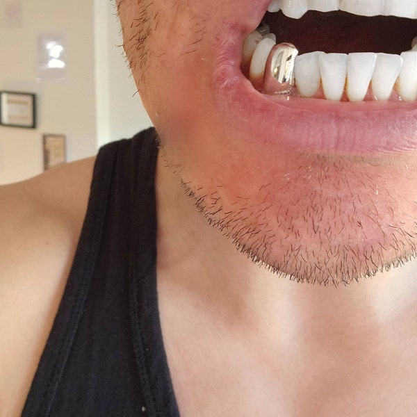 Gold Window/open Face Grillz Tooth Cap Worldwide Shipping White, Rose ...