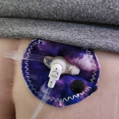 Cute Tubie Tape NG Tube Tape Gtube Tape Anime, Girls & Boys Oxygen ...