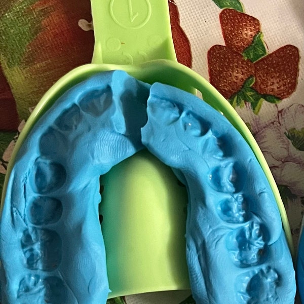 Dental Putty and Upper and Lower Trays for Impressions/putty for Night ...