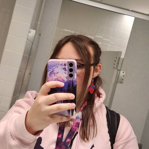 HOLOGRAPHIC Brain MRI/CT Vinyl Sticker | Anatomical Neuro Art - Etsy