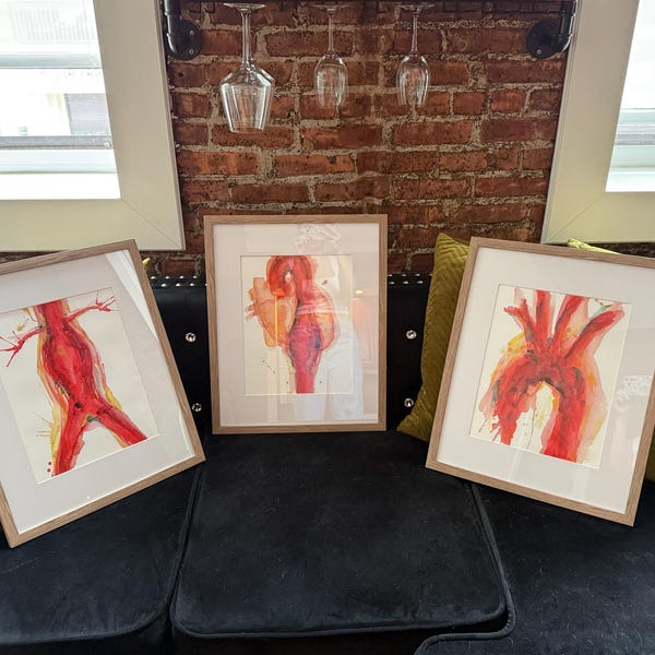 Cochlear Implant Electrode Array Watercolor Print - Audiology, ENT and ...