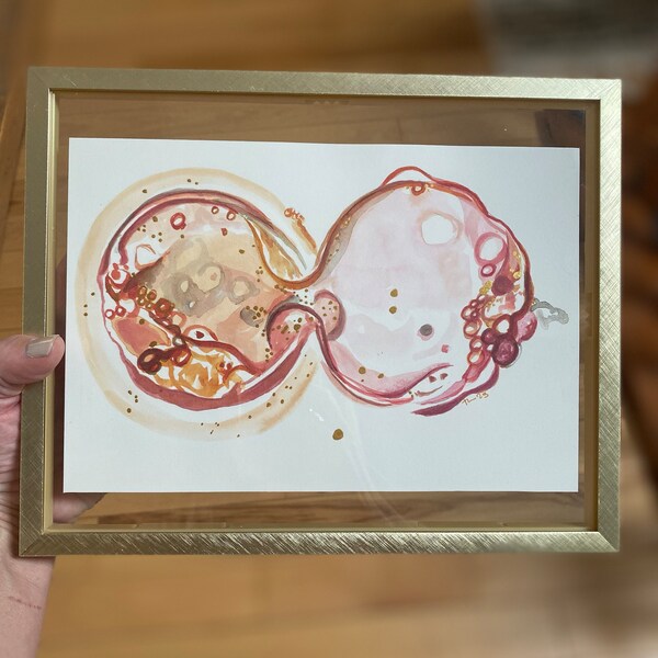 Custom Embryo Art - Nursery - Baby Shower Gift - New Baby - IVF ...