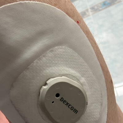 Premium Dexcom G6 Patch Plus Dexcom Transmitter Stickers No Lift Princess Dexcom Overpatch ...