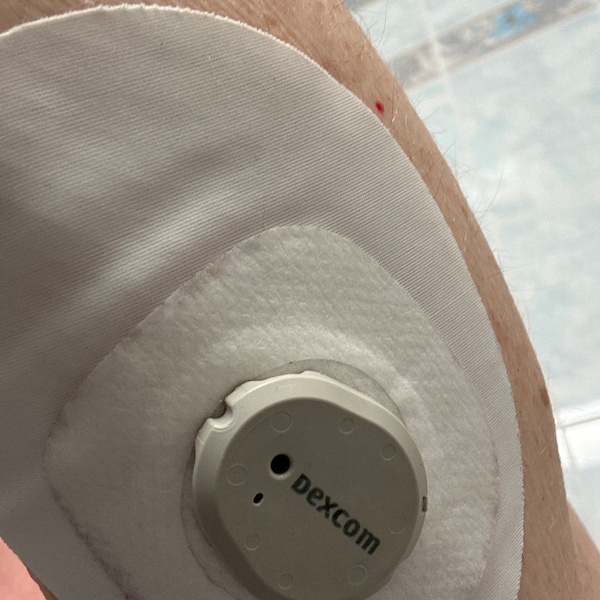 Glucomart Universal Adhesive Underpatch for Dexcom G6 & G7, Medtronic ...