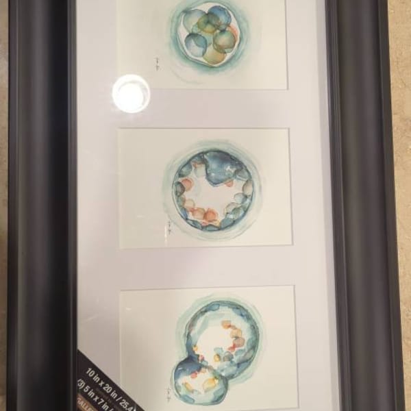 Embryo Set of 3 Watercolor Print - Fertility and IVF Three Art Prints ...