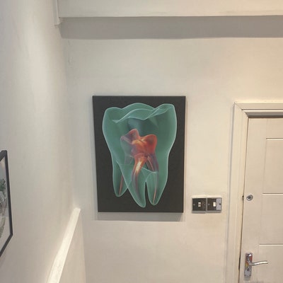 X-ray Molar Tooth, Dental Art, Dentist Art, Dental Clinic Deco Canvas ...