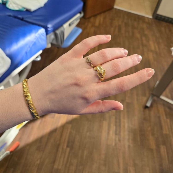 Trigger Finger Rings, Arthritis Ring, Mallet Finger Rings, EDS Finger ...