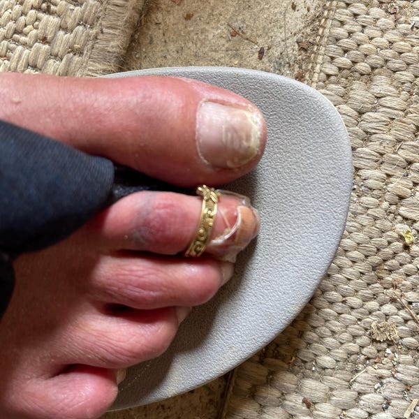 Trigger Finger Rings, Arthritis Ring, Mallet Finger Rings, EDS Finger ...