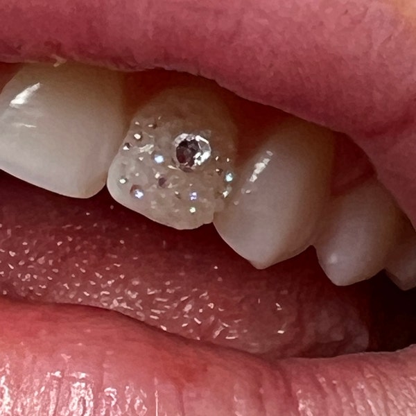 Tooth Gem Placement Tool - Etsy