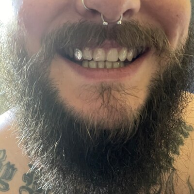 Double Tooth Caps Grillz With Iced Out Diamond Window Moissanite VVS ...
