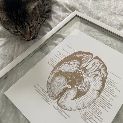 Human Brain Anatomy Medical Student Gift Foil Print Doctors Office ...