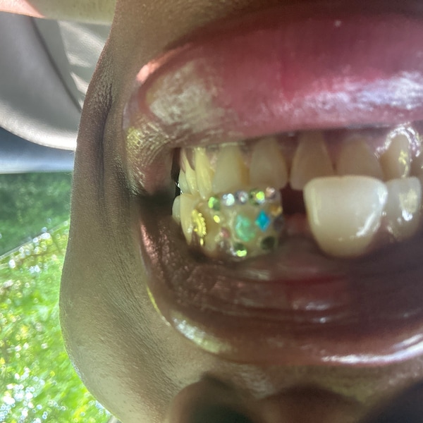 Tooth Gem Grafitti Light up Sign - Etsy