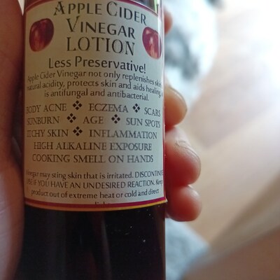 Apple Cider Vinegar Lotion - Etsy