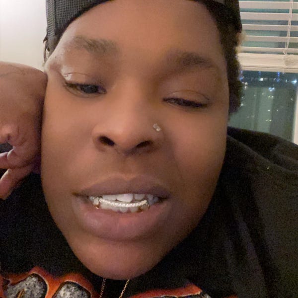 Custom Solid Gold Grillz / Permanent Cut / Deep Cut Custom Gold Grillz ...