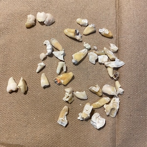 10 Real Human Teeth molars, Premolars, & Anteriors - Etsy