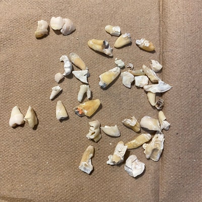 10 CRACKED AND BROKEN Real Human Teeth Molars, Premolars, & Anteriors ...