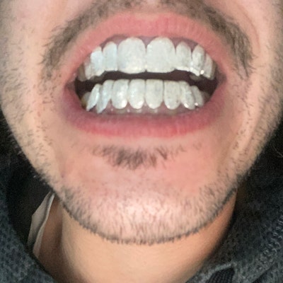 Silver Grillz 925 Sterling Silver Teeth Real Diamond Dust Silver Grill ...