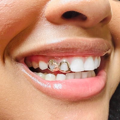 Custom Open Face Grillz Near Here Most Chosen Grillz 925 - Etsy