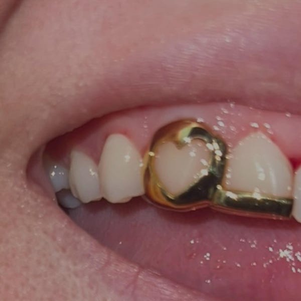 Custom 10 Piece Grillz Set With Trillion Tips and Open Windows in Two ...