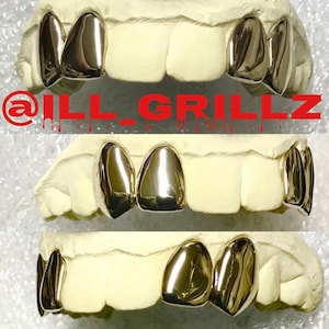 Handmade Custom .925 Sterling Silver Grillz - Etsy