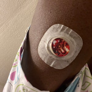 Premium Dexcom G6 Patch Plus Dexcom Transmitter Stickers No Lift ...