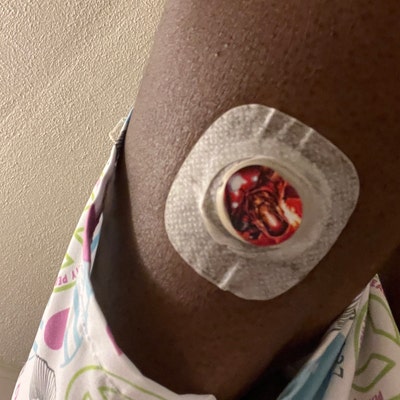 Premium Dexcom G6 Patch Plus Dexcom Transmitter Stickers No Lift ...