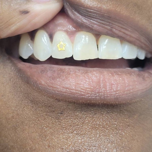 14k 18k Tooth Gem Twinkle Gold Star - Etsy