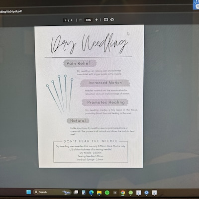 Dry Needling Poster - Etsy