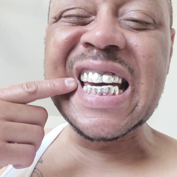 Sterling Silver Grillz 925 Custom Silver Teeth Real Diamond Dust Silver ...