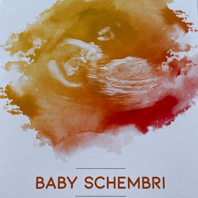 Personalised BABY Scan Ultrasound Watercolour Greeting Card 4D First ...