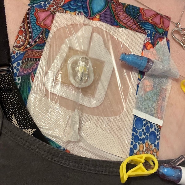 Extra Large Medical Port Cover, SPC Tube-suprapubic Catheter, GJ Tube ...