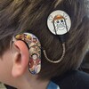 Cochlear Implant Skins for Nucleus 8, Nucleus 7, Sonnet 2, AB Marvel ...