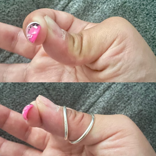 BUNDLE OF 10 Adjustable Swan Splint Ring - Sterling Silver Swan Splint ...