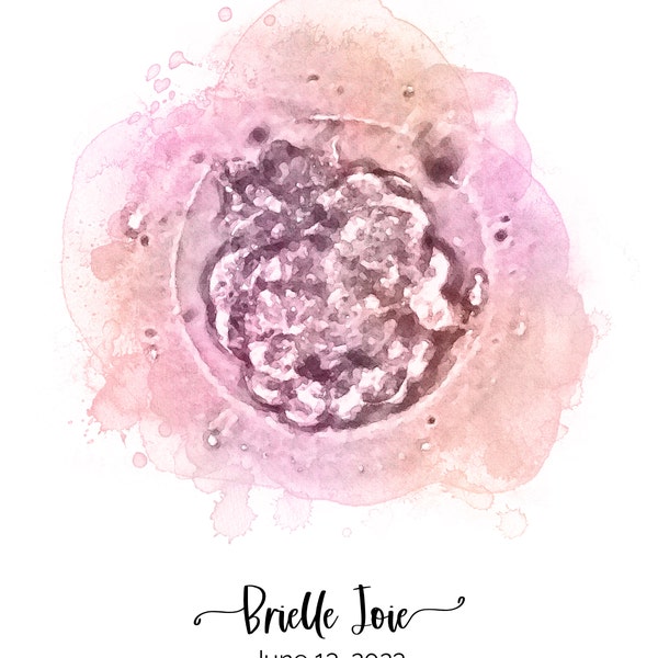 Custom IVF Art Embryo Watercolor Personalized Pregnancy Gift Nursery ...