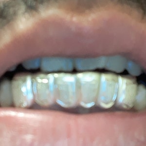Sterling Silver Grillz 925 Custom Silver Teeth Real Diamond Dust Silver ...
