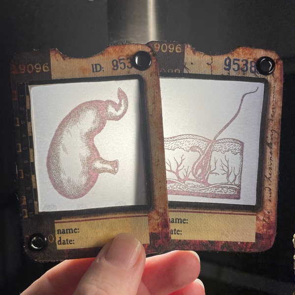 X-ray Slides With Tray, Human Skeleton, Vintage Medical Pathology Cards ...