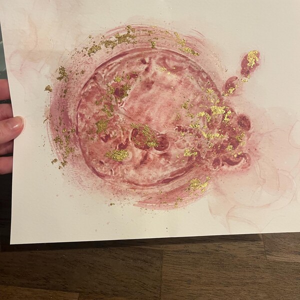 Custom Miniature Embryo Art, Framed Embryo Art, IVF Embryo Painting ...