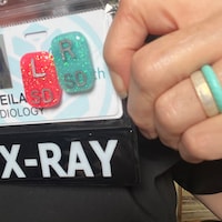 Rao Rpo Lao Lpo, Ap, Pa, Positional Xray Markers, Rectangle, Glitter, X ...