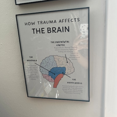 How Trauma Affects the Brain, Therapy Office Decor, Therapy Wall Art ...
