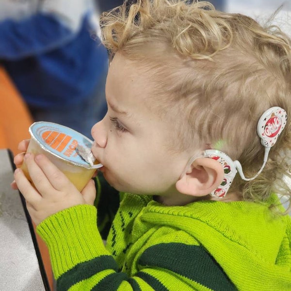 Cochlear Implant Skins Cochlear Implant Stickers - Etsy