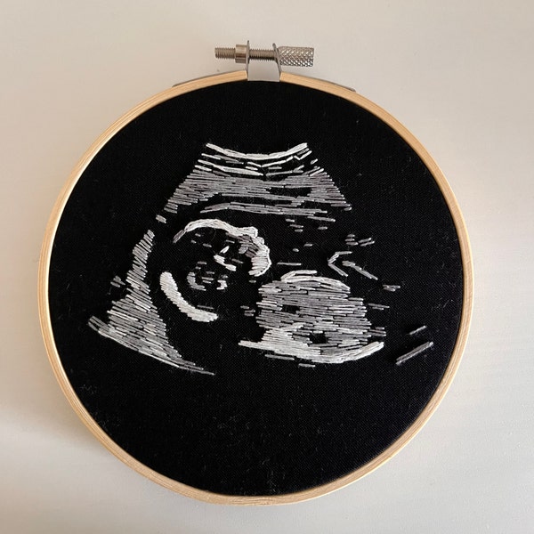 Ultrasound , Custom Ultrasound Embroidery | Baby Shower Gifts | Baby ...