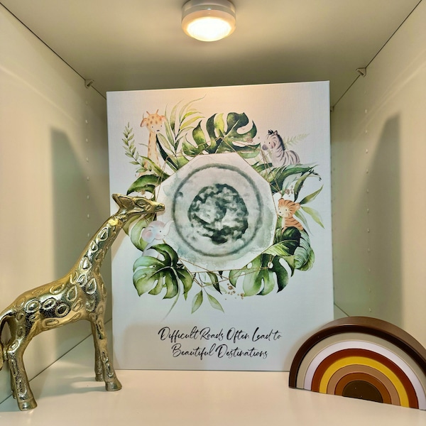 Custom IVF Art Embryo Watercolor Personalized Pregnancy Gift - Nursery ...