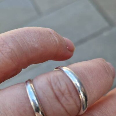 Arthritis Rings, Silver Splint Ring, Adjustable Ring for PIP or DIP ...