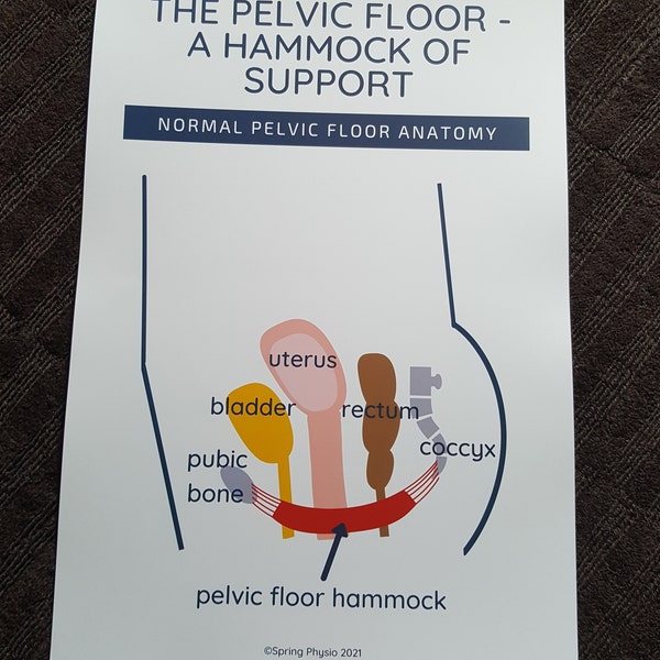 A4 Anatomy Poster | Pelvic Organ Prolapse Poster | Pelvic Floor ...